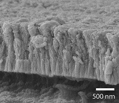 Biodegradable bone implants