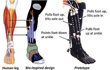 Robotic device has therapeutic potential for ankles and feet