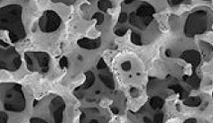 Orteq develops biodegradable scaffold for meniscus surgery